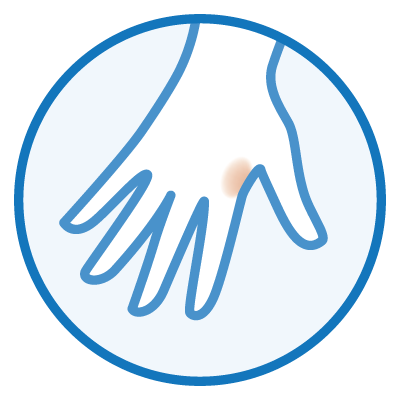 Services - Aylesworth Dermatology